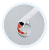 Types of Catheter Occlusions - Cathflo® Activase® (alteplase)