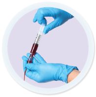 Cathflo® Activase® (alteplase) Administration