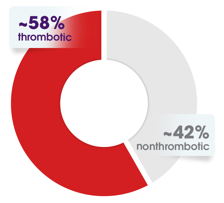 Types of Catheter Occlusions - Cathflo® Activase® (alteplase)
