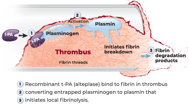 Cathflo® Activase® (alteplase) Mechanism of Action